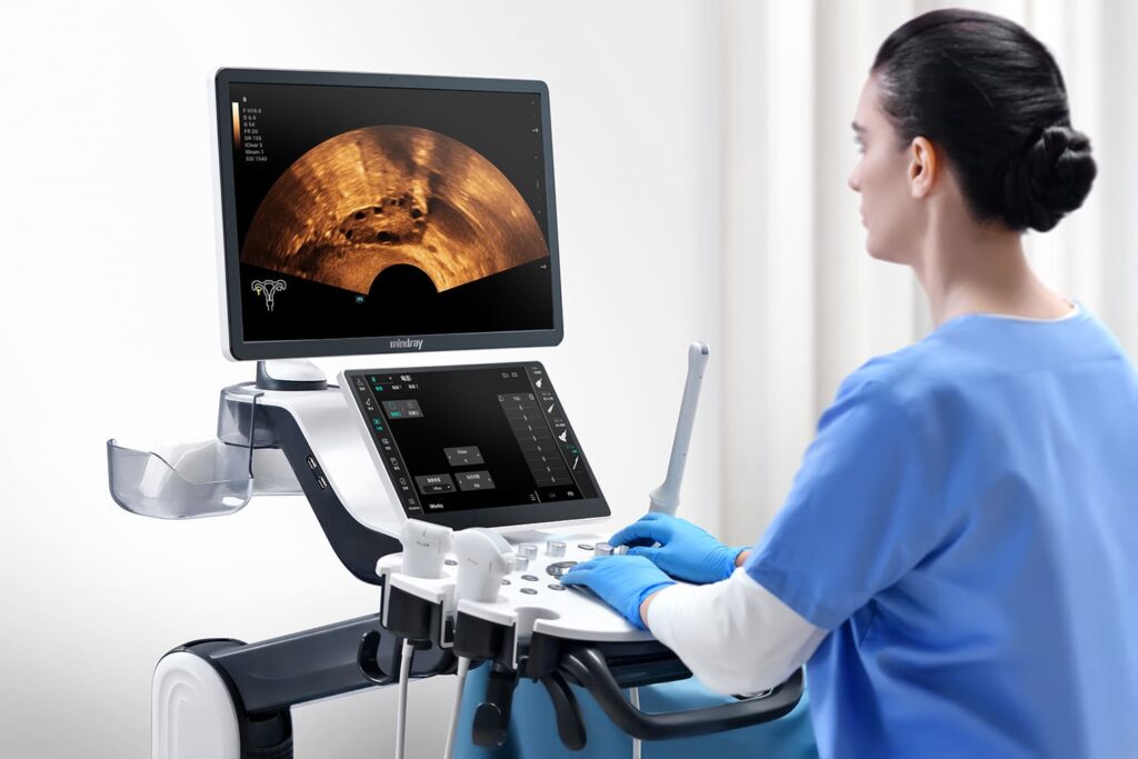 Mindray N6 – Equipos Medicos Dalmed