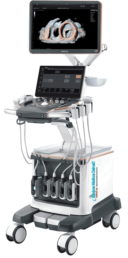 Mindray Recho R9 - Equipos Medicos Dalmed